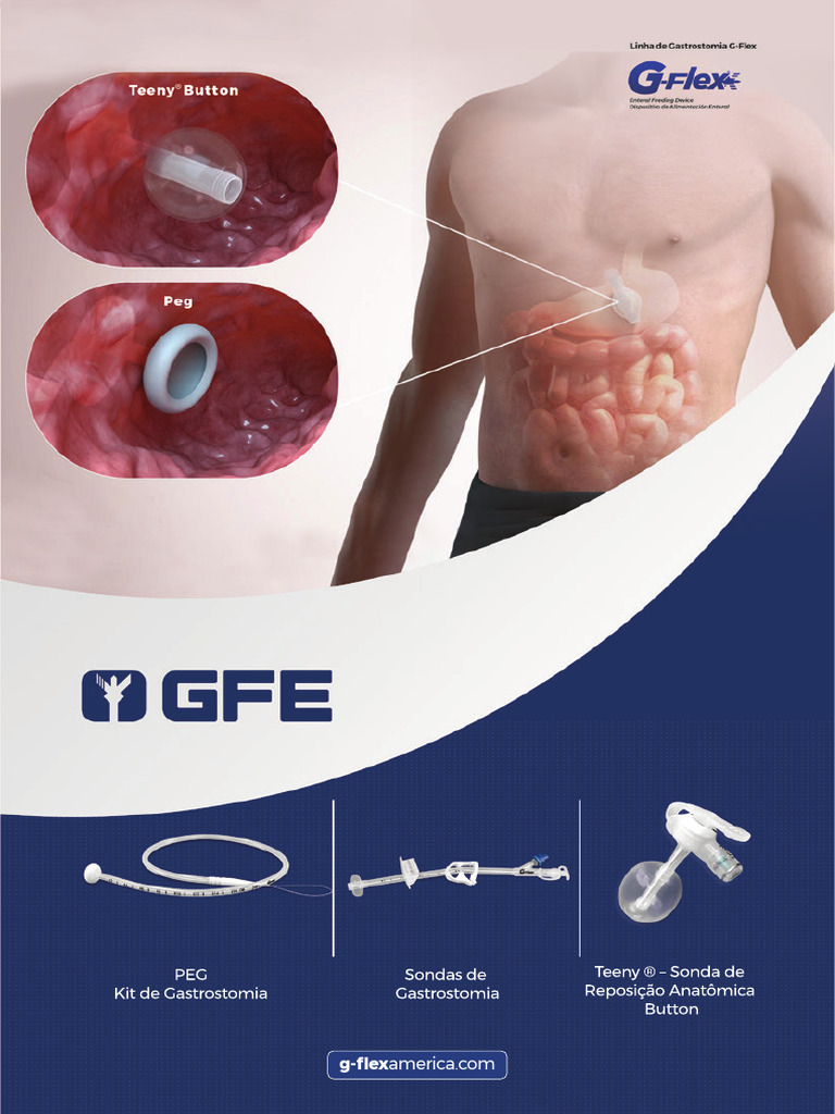 Gfe Catalogo Gastrostomia SITE | PDF