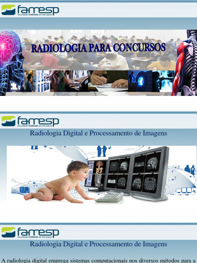 Aula 03 - Radiologia Digital e Processamento de Imagens | PDF ...
