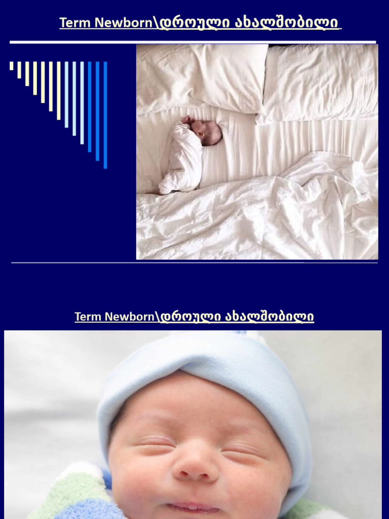 Term Newborn 2023++ | PDF
