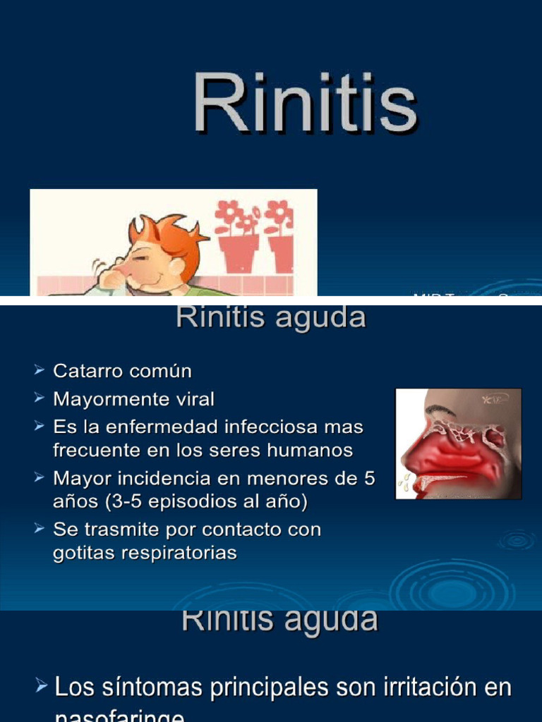 Clase 4 Rinitis Agudas | PDF