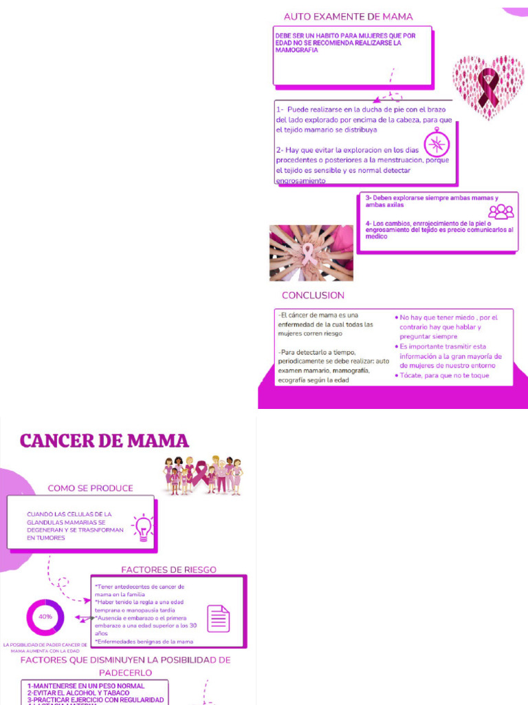 Cancer de Mama.pdf | PDF