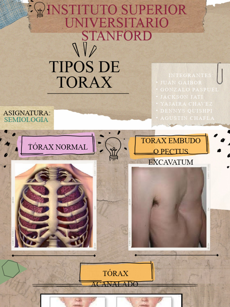 Tipos de Torax | PDF