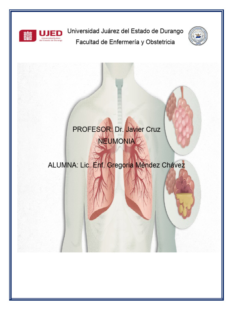 Fisiopatología y Tipos de Neumonía | PDF | Neumonía | Tos