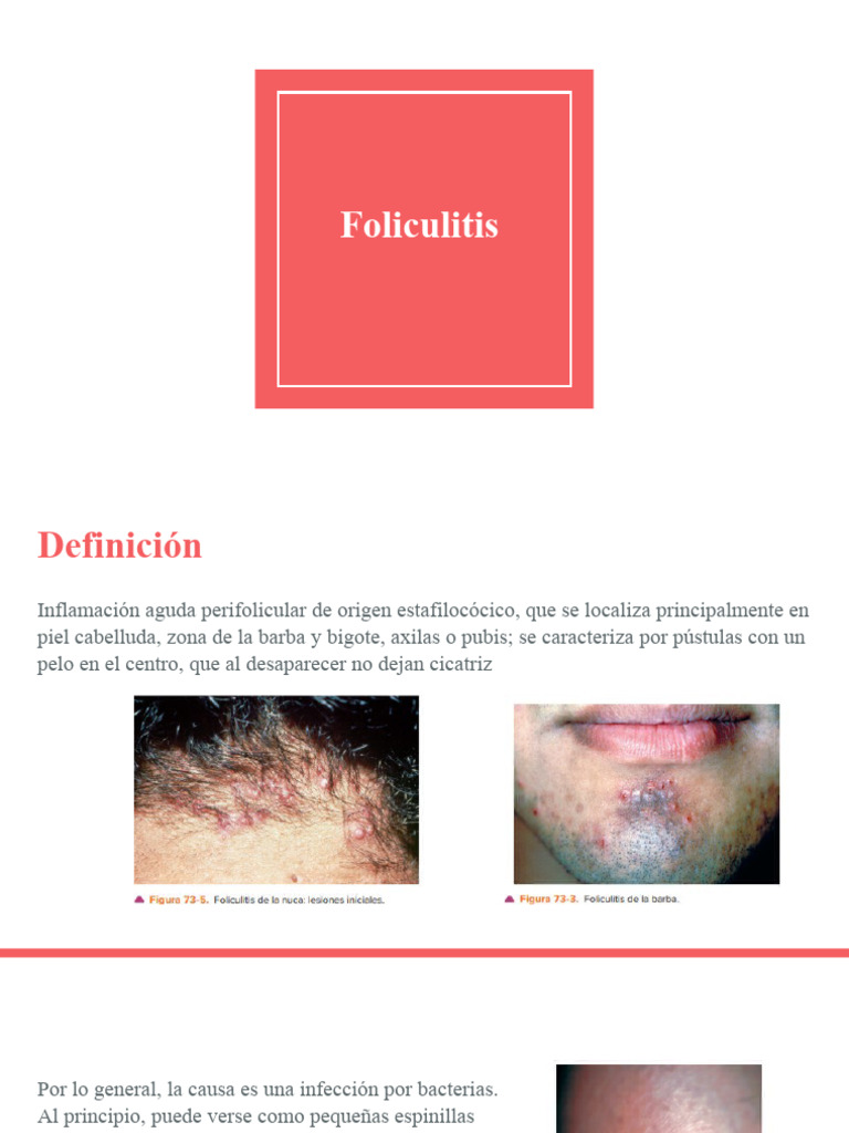 Tipos y Tratamientos de Foliculitis | PDF | Pelo | Especialidades Medicas