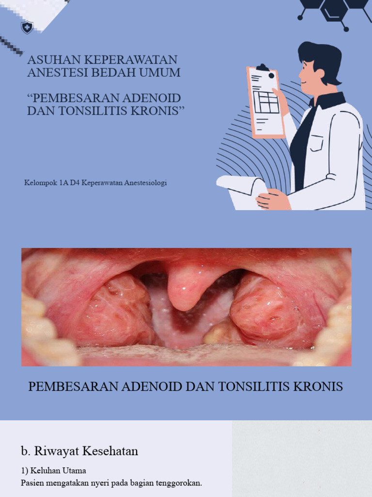 Askan Tonsilitis | PDF
