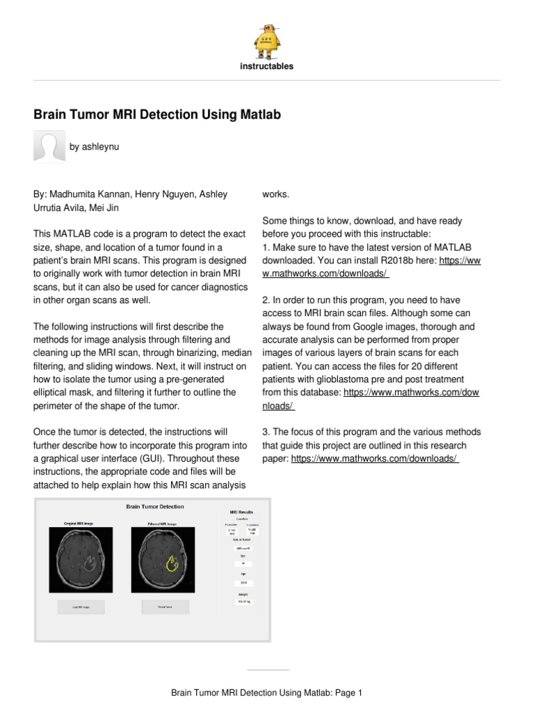 MATLAB Brain Tumor Detection Guide | PDF | Cartesian Coordinate System ...