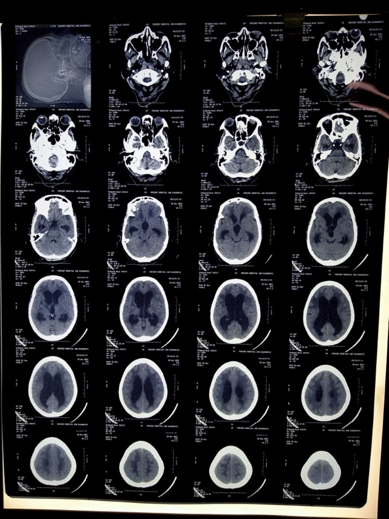 CT Plate | PDF