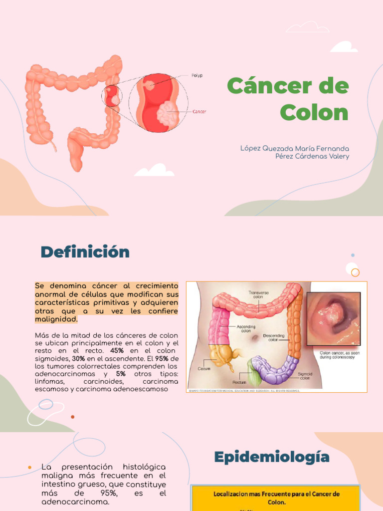 Ca Colon | PDF | Cáncer colonrectal | Cáncer