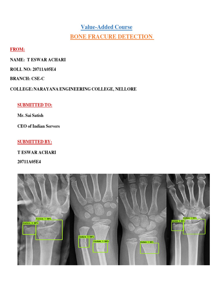 AI-Powered Bone Fracture Detection | PDF | Machine Learning ...