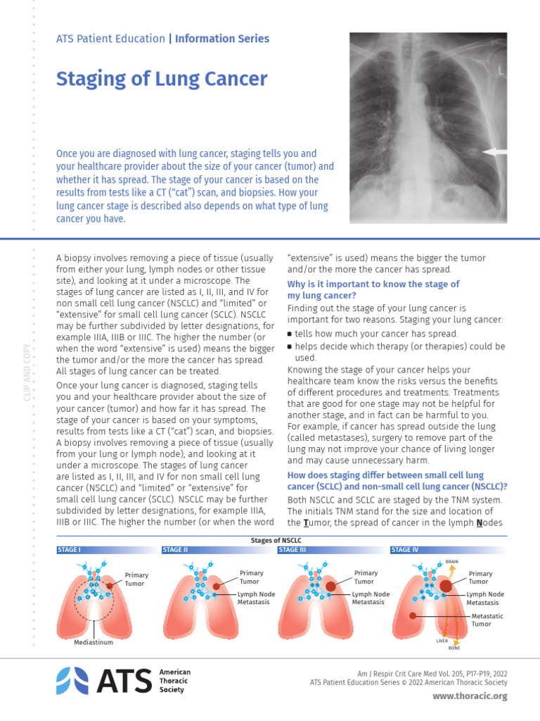 Lung Cancer Staging | Download Free PDF | Lung Cancer | Metastasis