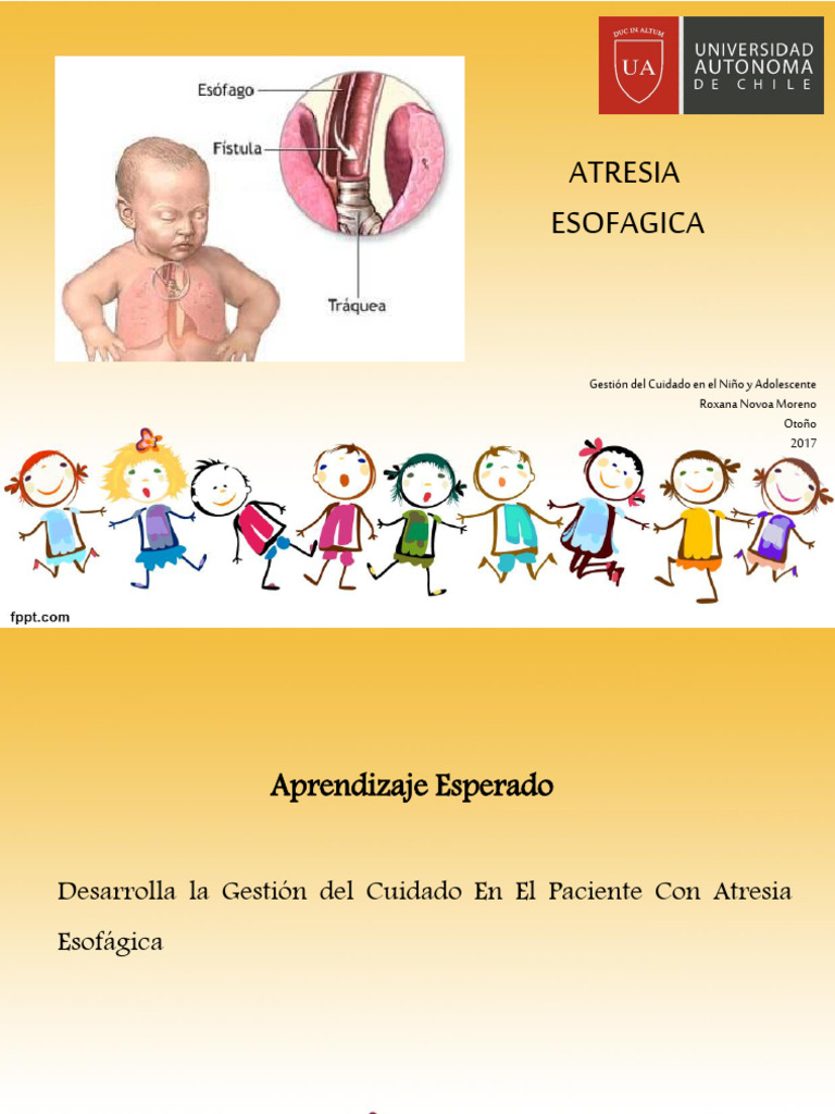Manejo de Atresia Esofágica en Neonatos | PDF | Enfermedades y ...