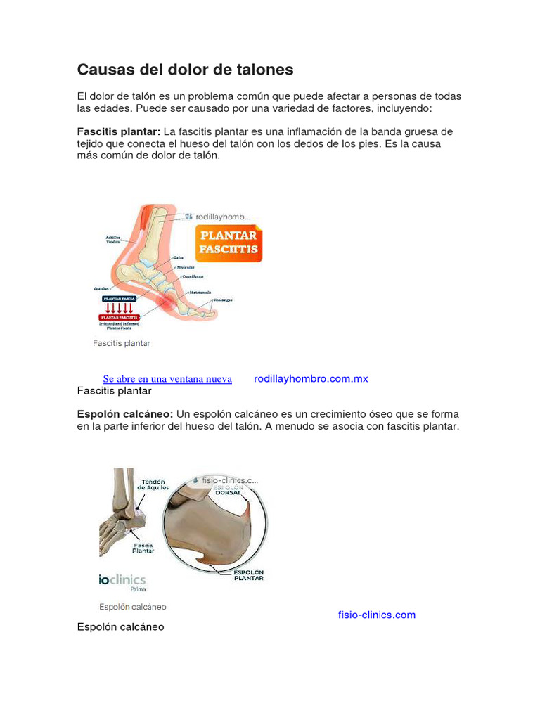 Causas y tratamientos del dolor de talón | PDF | Especialidades Medicas ...