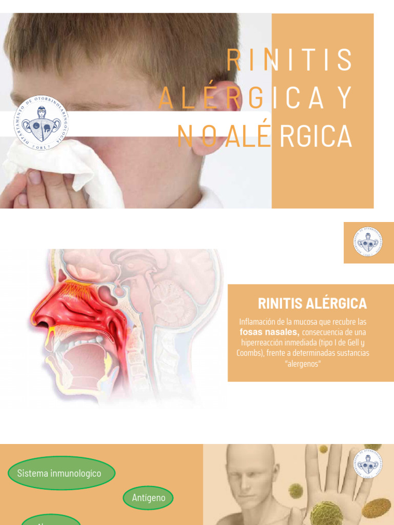 Rinitis Alergica | PDF | Alergia | Especialidades Medicas