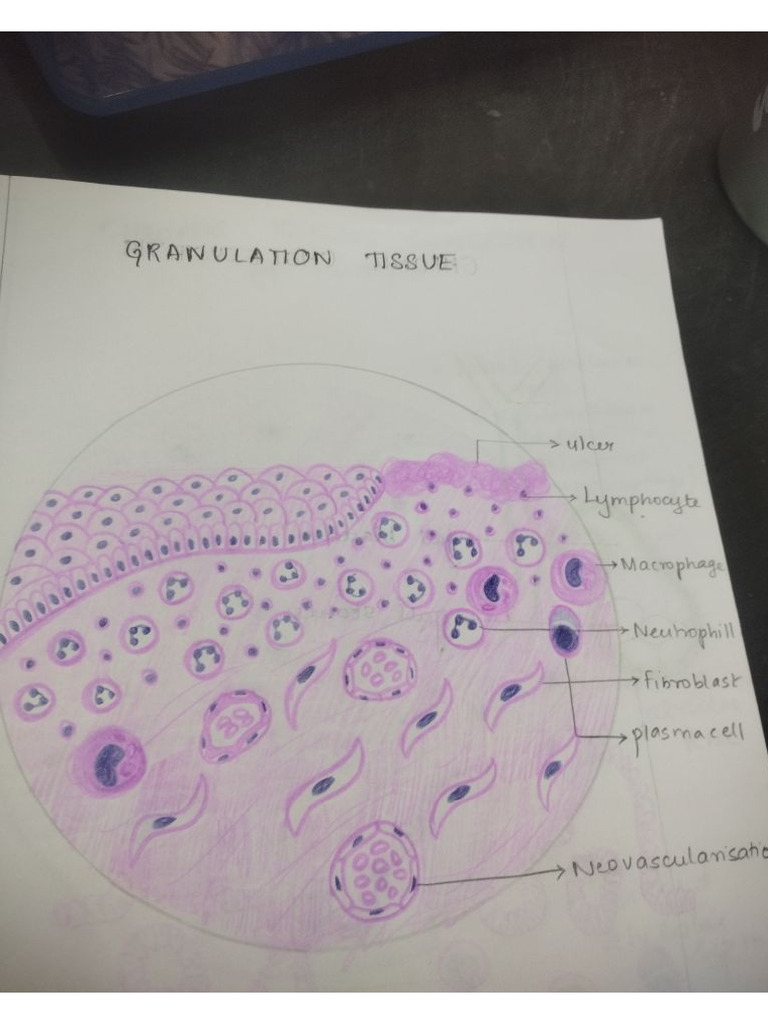 granulation tissue | PDF