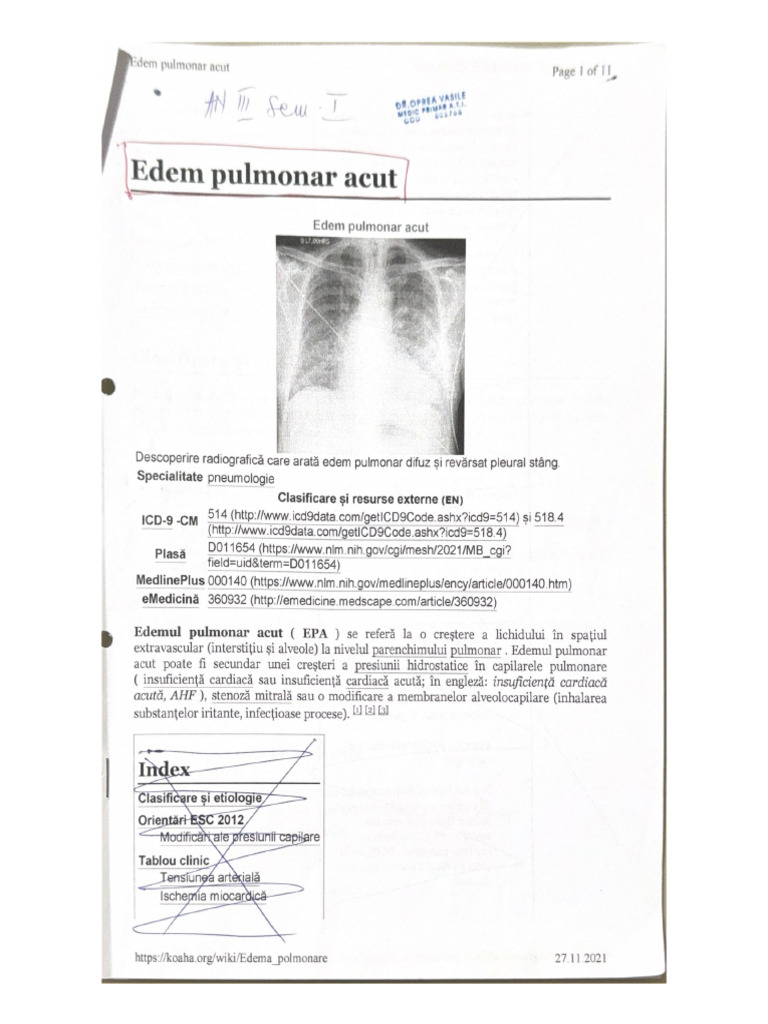 Edem Pulmonar Acut | PDF