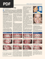 Oclusion Fosa Cuspide | PDF | Anatomia dental | Diente