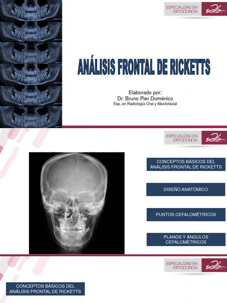3.1. - Analisis Frontal de Ricketts | PDF | Anatomía humana | Sistema esquelético