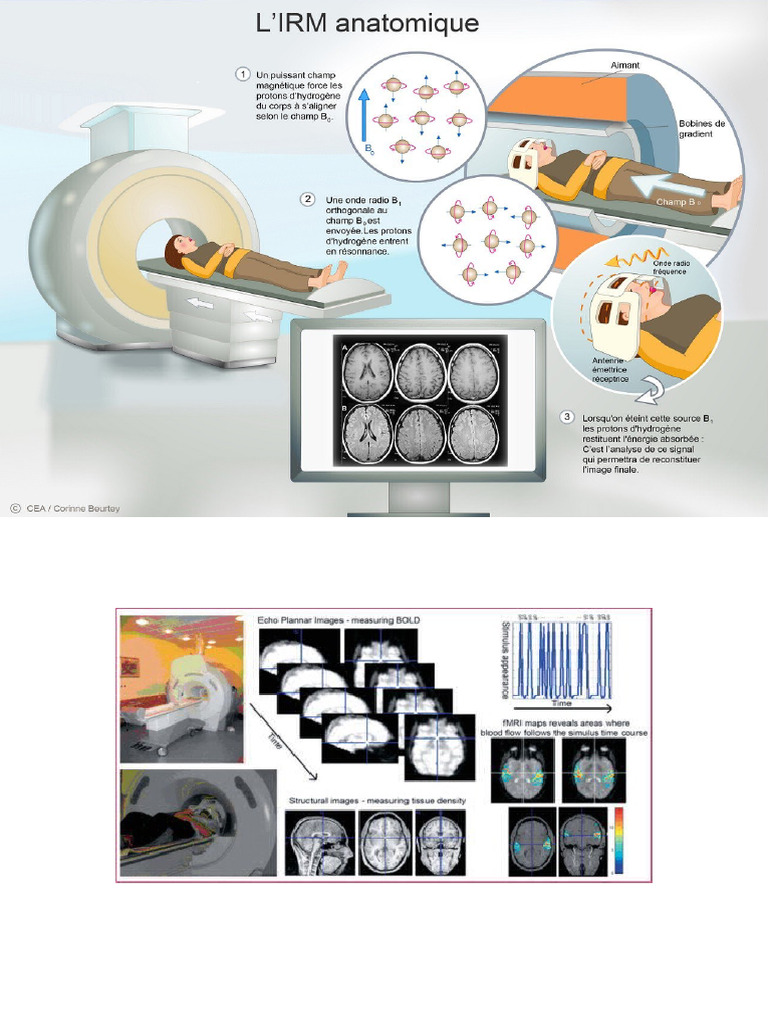 IRM Exercice | PDF | Imagerie par résonance magnétique | Neuroscience
