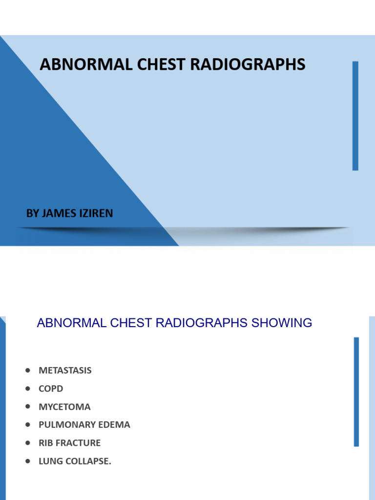 Abnormal Chest Radiographs | Download Free PDF | Metastasis | Lung