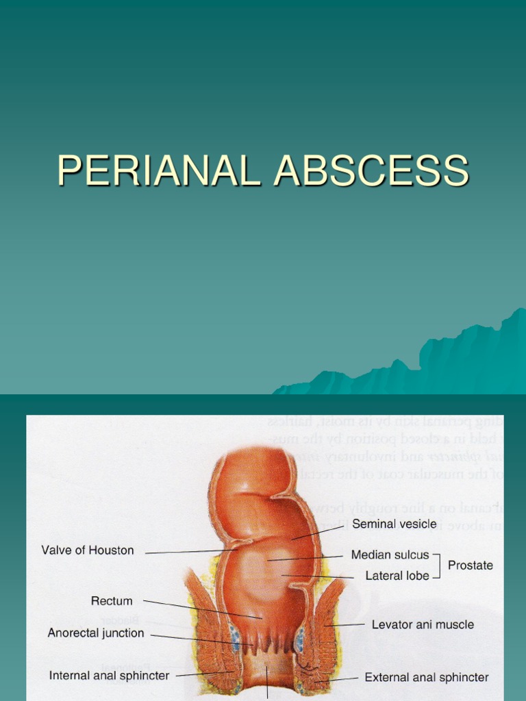 PERIANAL Pathologies | PDF | Hemorrhoid | Medicine