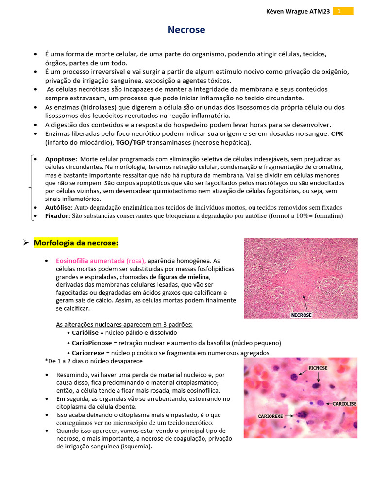 Tipos e Características da Necrose | PDF | Necrose | Edema
