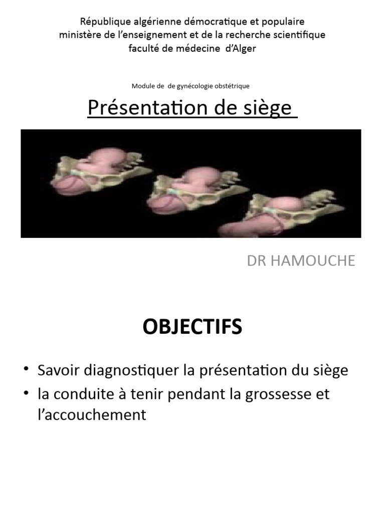 Présentation du siège en obstétrique | PDF | Accouchement | Grossesse ...
