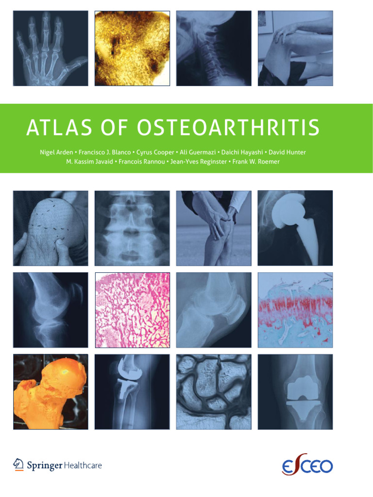 Arden, Nigel - Atlas of Osteoarthritis-Springer Healthcare | PDF ...