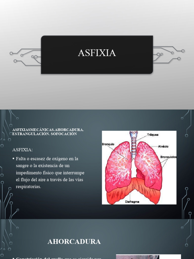 Asfixia y Ahorcadura: Tipos y Características | PDF | Arte | Estilo de vida