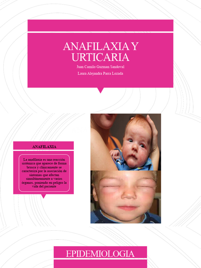 Urticaria | PDF | Alergia | Medicina