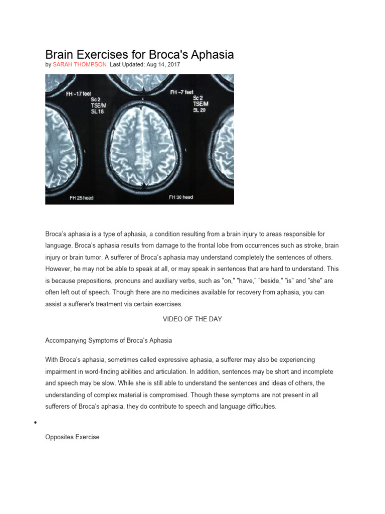 Brain Exercises For Broca | PDF | Aphasia | Speech