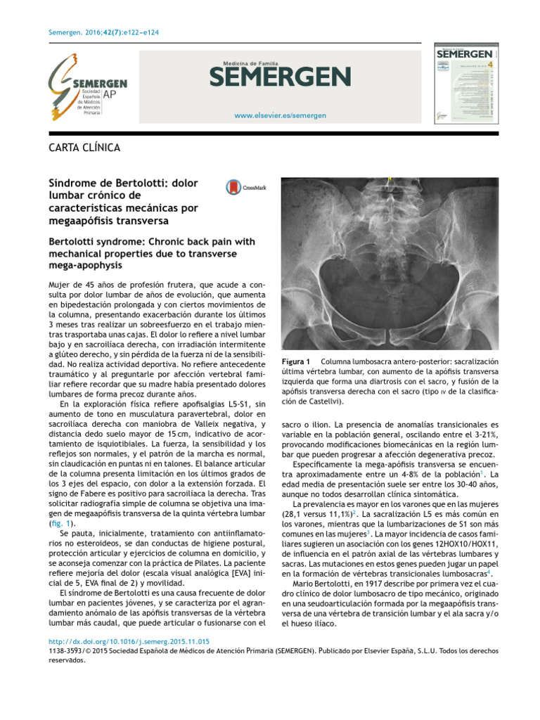 Carta Clínica Síndrome de Bertolotti | PDF | Dolor lumbar | Sistema ...
