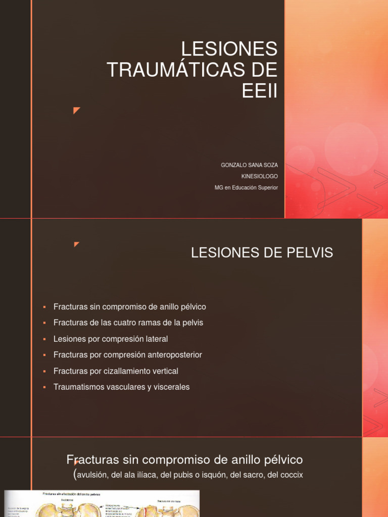 Lesiones Traumáticas Del Eeii | PDF | Rodilla | Tobillo