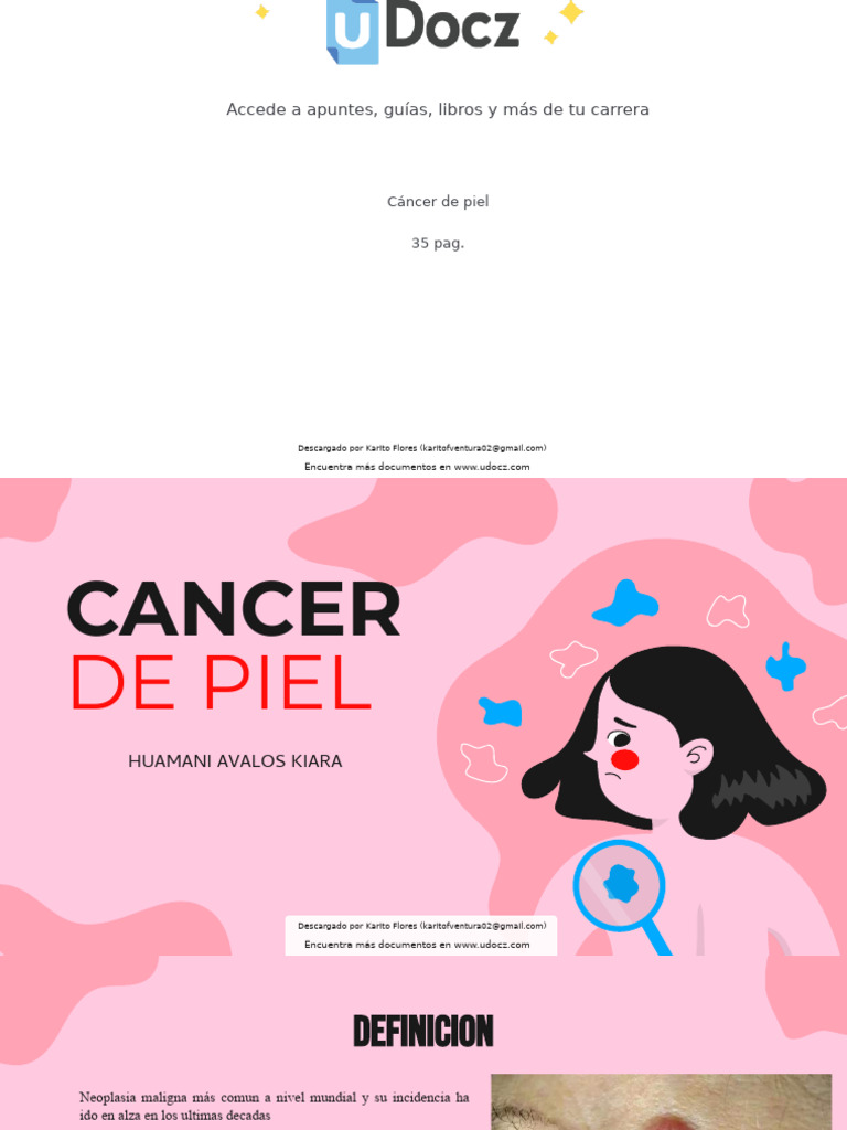 Cancer de Piel 759437 Downloadable 395214 | PDF | Cáncer | Cáncer de piel