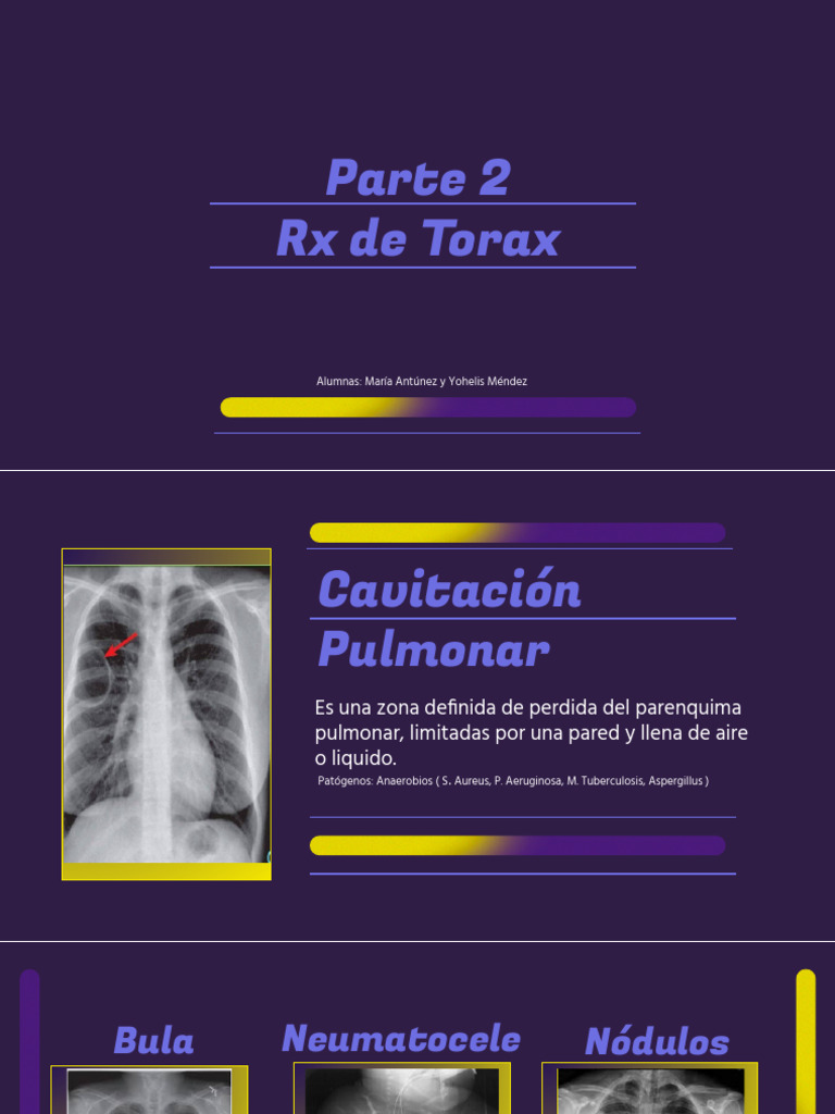 RX de Torax | PDF | Pulmón | Cáncer de pulmón
