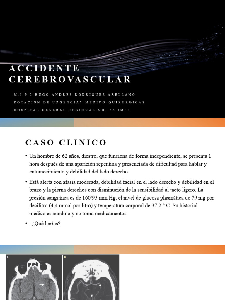 Manejo del Accidente Cerebrovascular | PDF | Isquemia | Carrera
