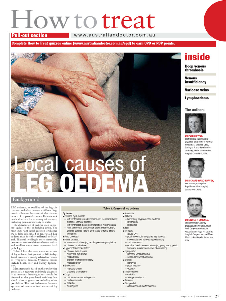 Leg Oedema | PDF | Thrombosis | Vein