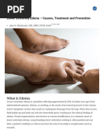 Oedema Assessment Guide | PDF | Edema | Vein