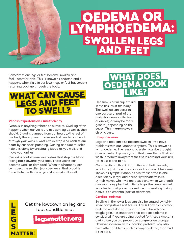 Legs Matter Patients Swollen Legs Feet A4 | PDF | Edema | Vein