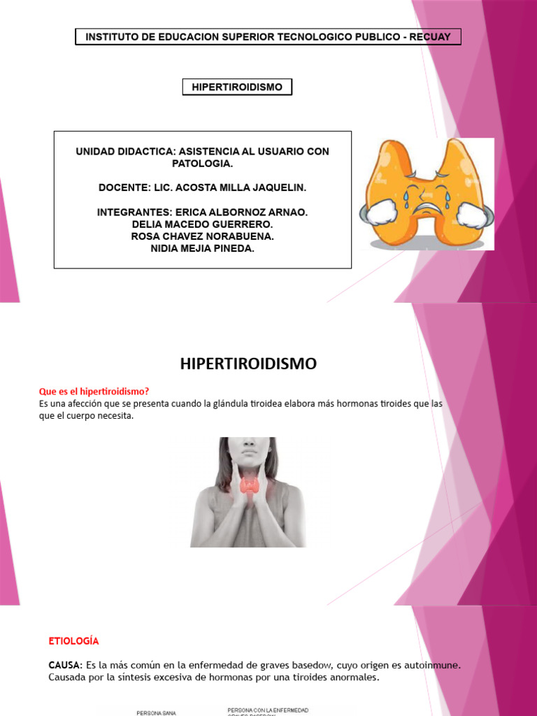 HIPERTIROIDISMO | PDF | Hipertiroidismo | Tiroides