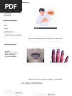 Signo de Dunphy | PDF