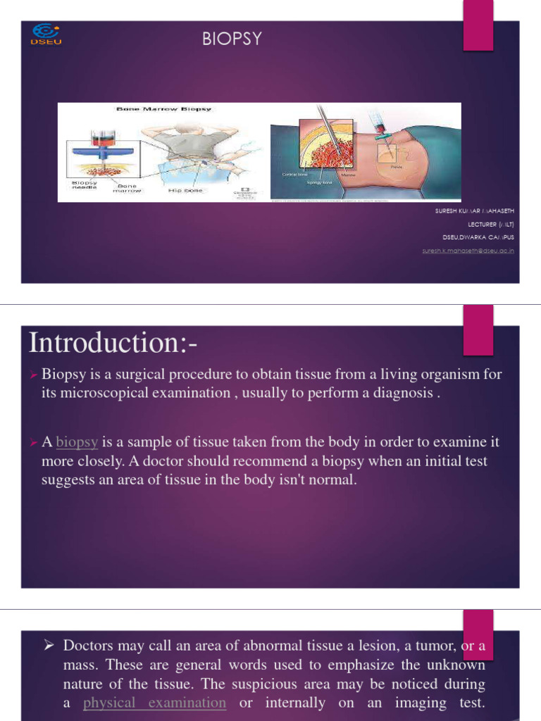 Biopsy | PDF | Biopsy | Cancer