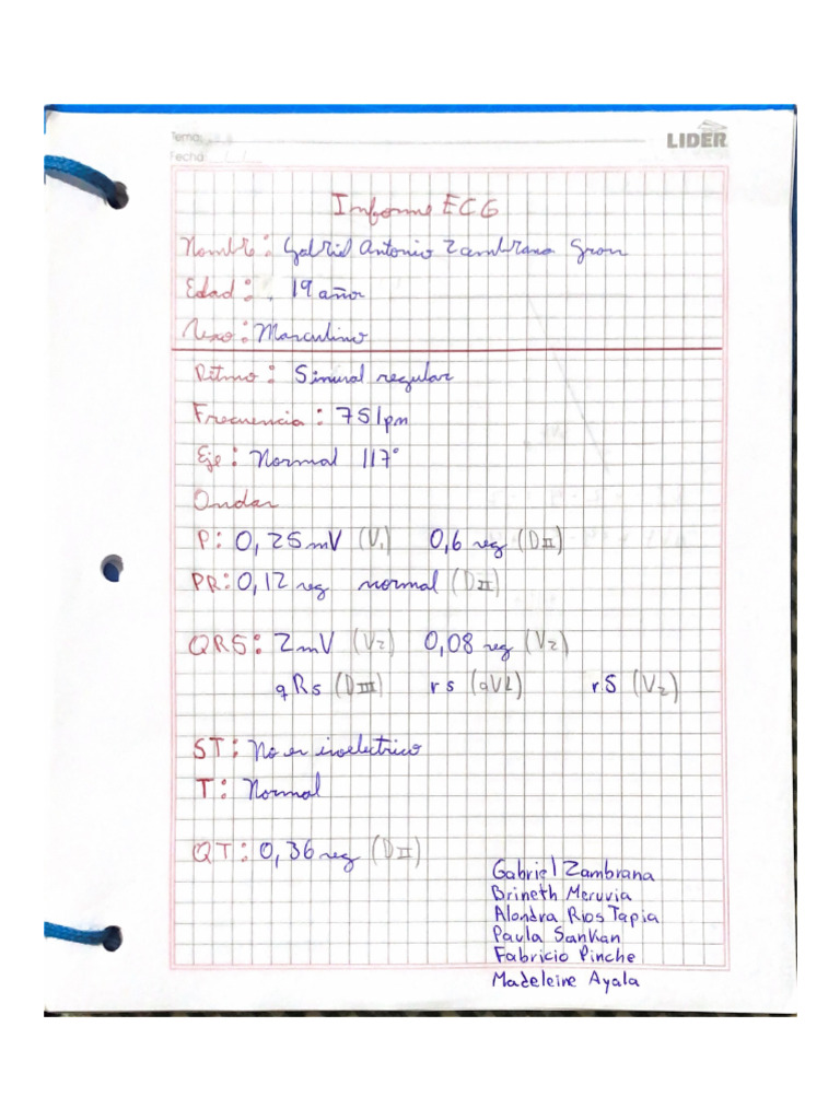 Interpretación Electro | PDF