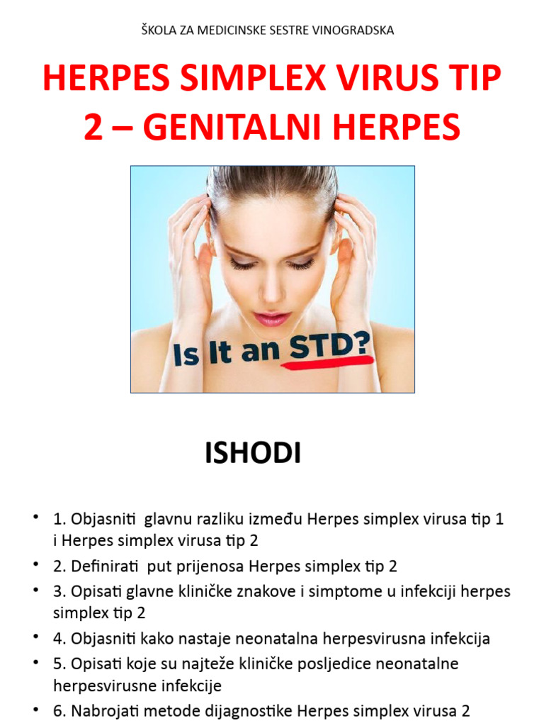 Herpes Simplex Virus Tip 2 - HSV 2 - 2024 | PDF