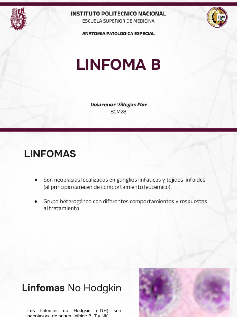 LINFOMA B | PDF | Linfoma | Cáncer