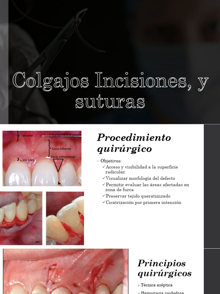 Colgajos Incisiones, y Suturas | PDF | Especialidades Medicas