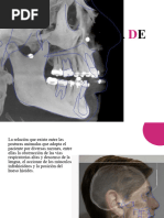 Analisis de Rocabado | PDF | Anatomía | Trastornos musculoesqueléticos