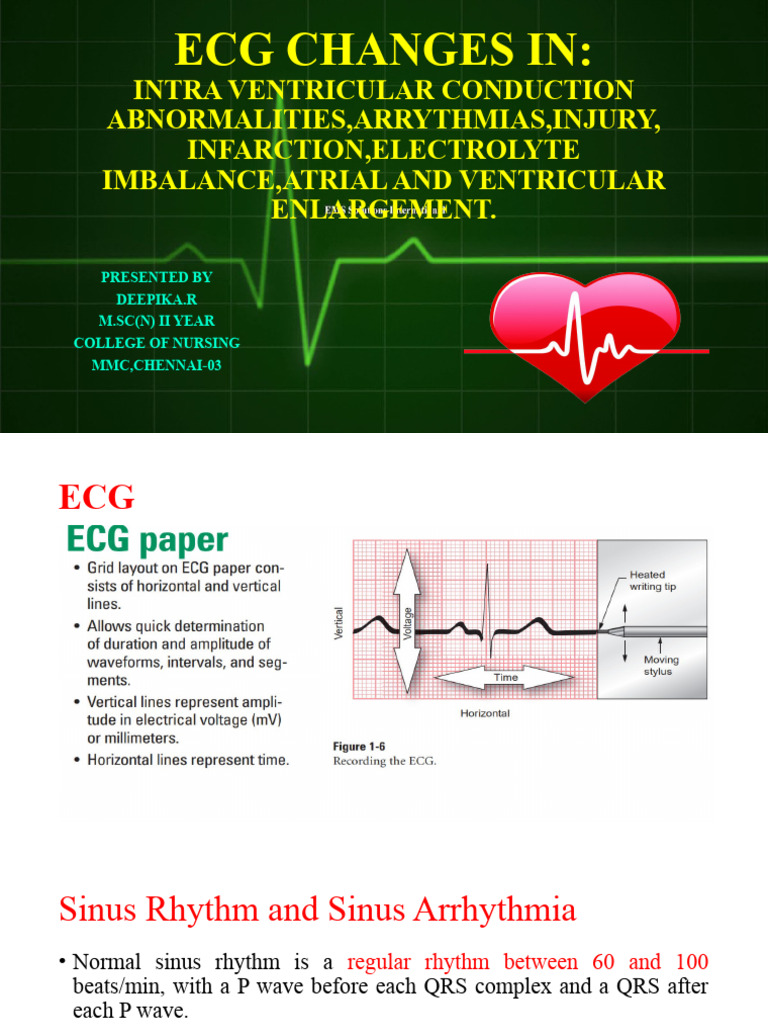ECG Changes | PDF | Electrocardiography | Electrophysiology
