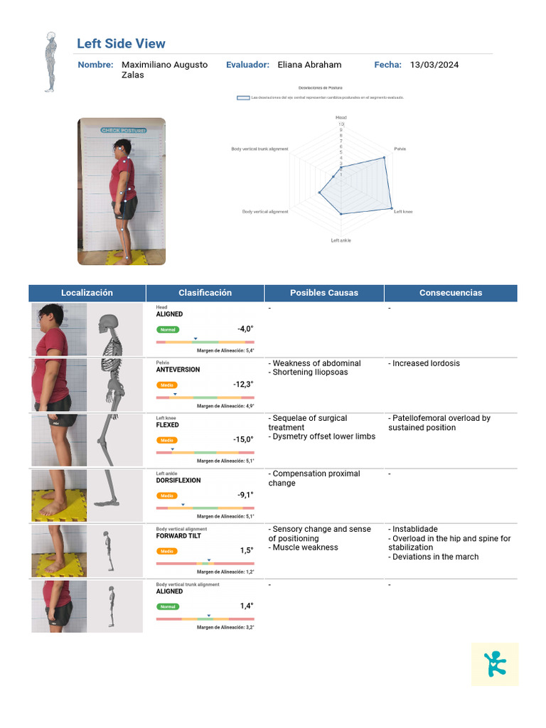 (Maximiliano Augusto Zalas) (13!03!2024) Left Side View, Right Side ...