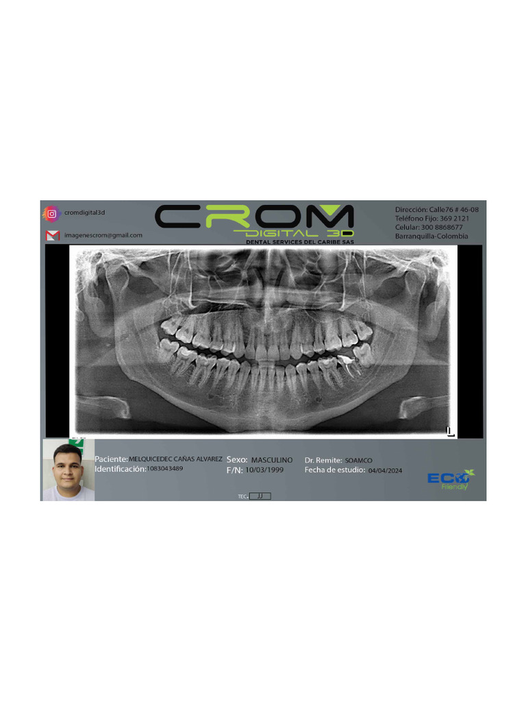 MELQUICEDEC CAÑAS ALVAREZ (1) Conv | PDF