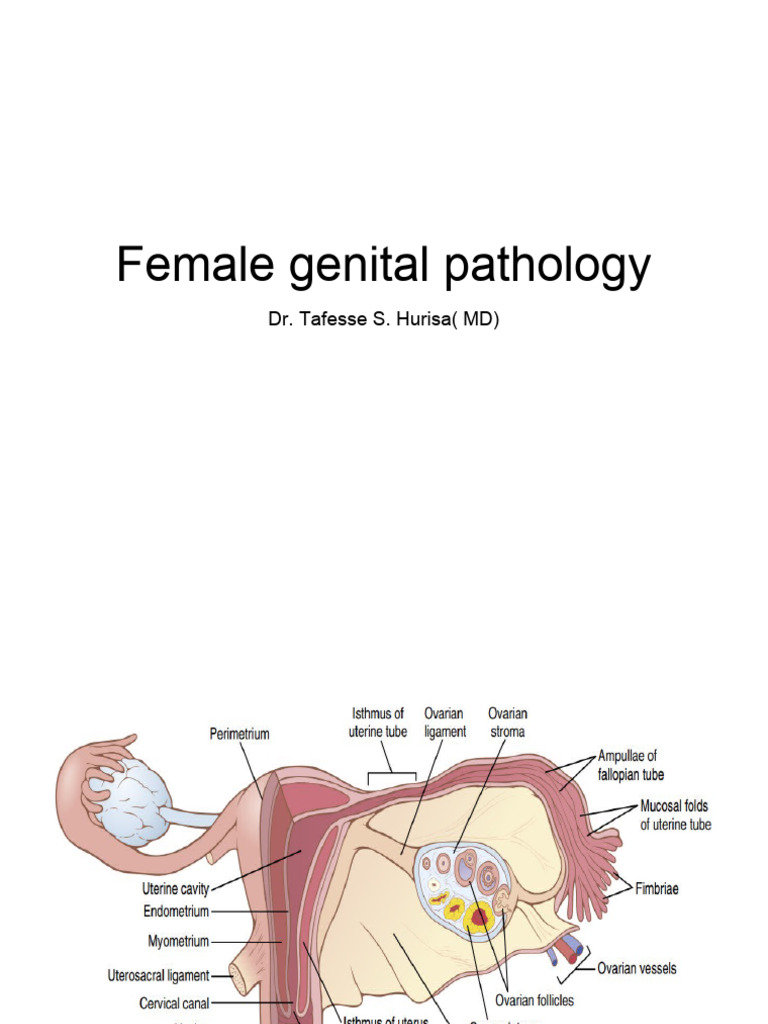 Female Genital Pathology | Download Free PDF | Ovarian Cancer | Carcinoma